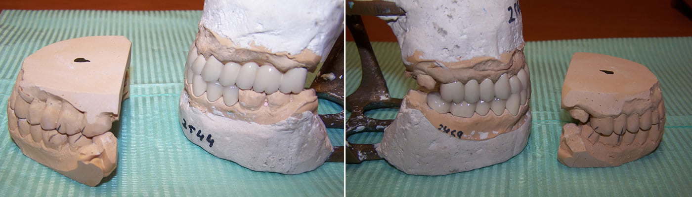 El Prognatismo – Dentalinfo